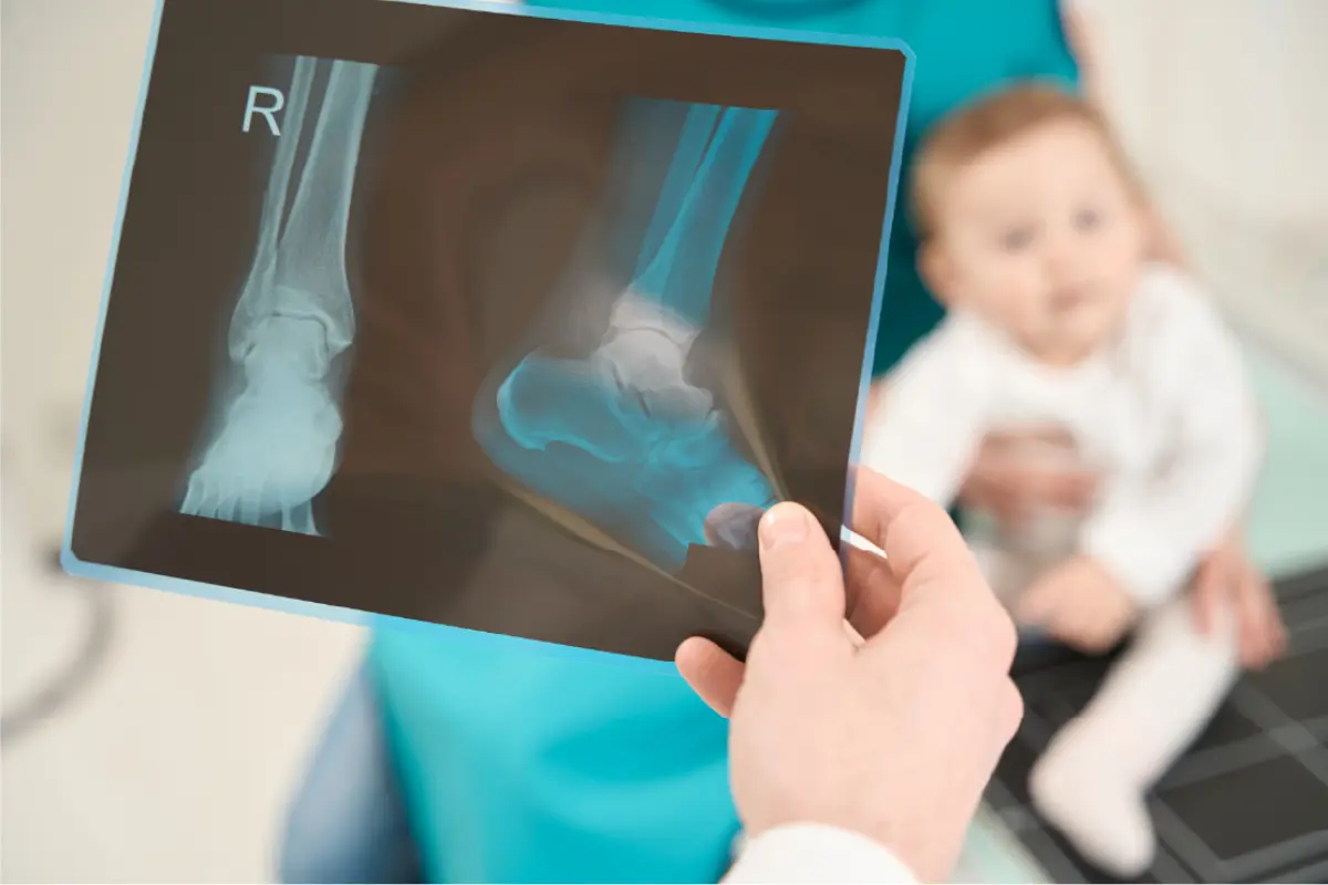 Informe radiológico convencional pediátrico - Mednet